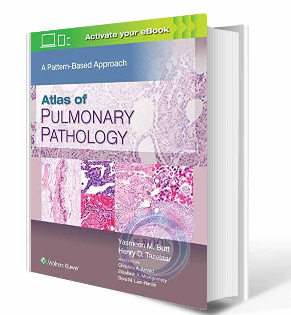 دانلود کتاب Atlas of Pulmonary Pathology: A Pattern Based Approach 2021 ...
